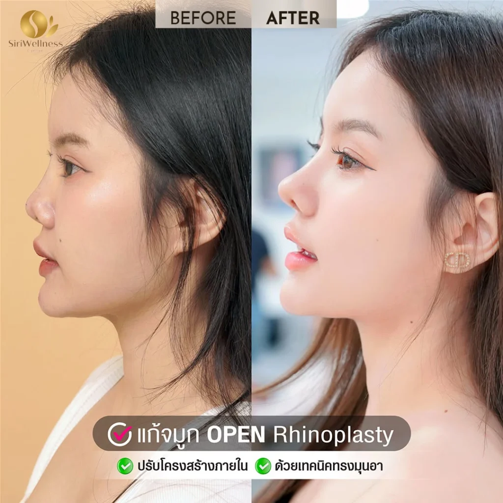 review dr pp - en - Siriwellness Center